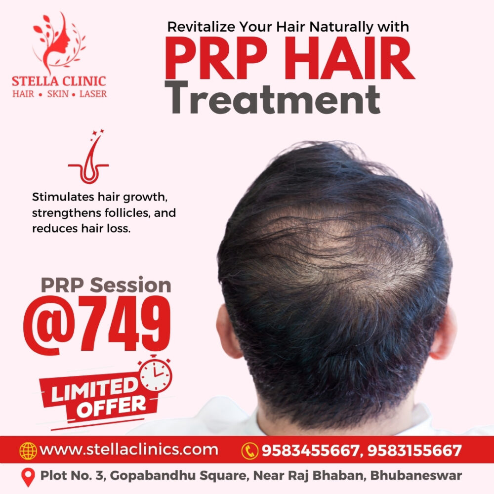 Revitalize Your Hair Naturally with PRP Hair Treatment Limited Time ...